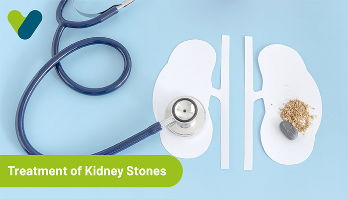 Kidney Stones Treatment: Complete Guide On Renal Calculi Treatment| Livlong